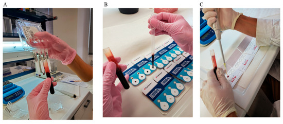 LC-MS-Based Global Metabolic Profiles of Alternative Blood Specimens ...