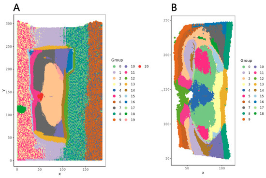 SMQVP: A Web Application for Spatial Metabolomics Quality Visualization ...