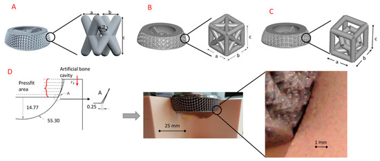 Metals | Special Issue : Titanium Alloys for Biomedical Implants and ...