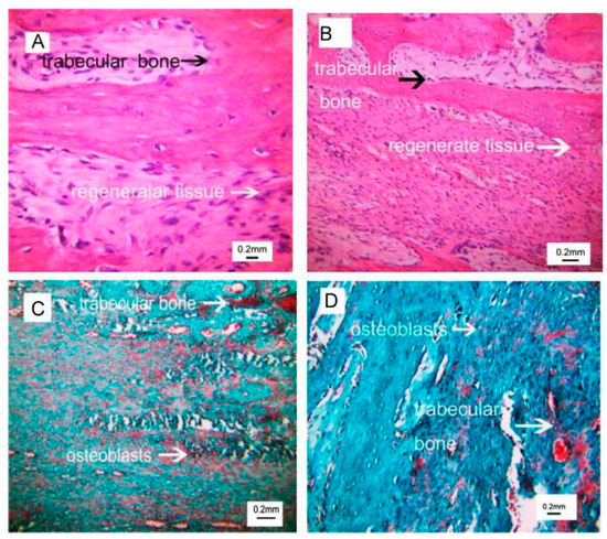 The Potential of Magnesium Based Materials in Mandibular Reconstruction
