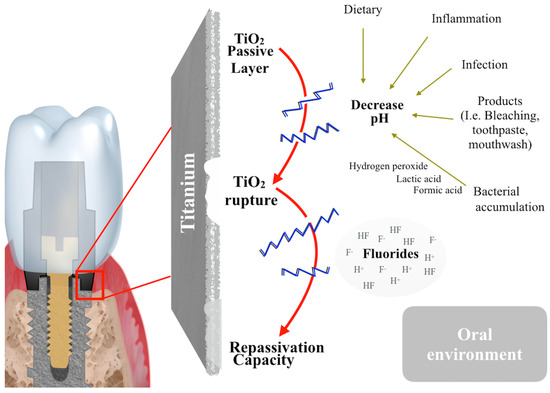 A Comprehensive Review on the Corrosion Pathways of Titanium Dental ...