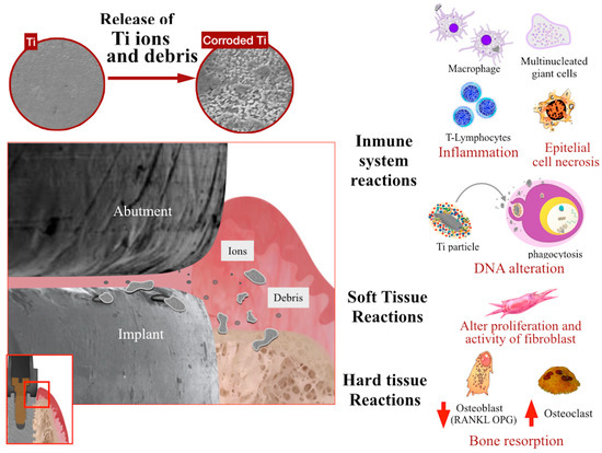 A Comprehensive Review on the Corrosion Pathways of Titanium Dental ...