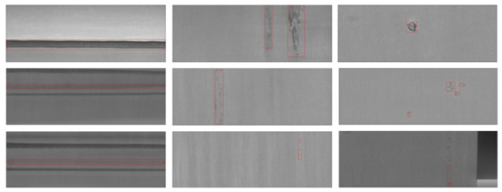 A Multi-Branch U-Net for Steel Surface Defect Type and Severity ...