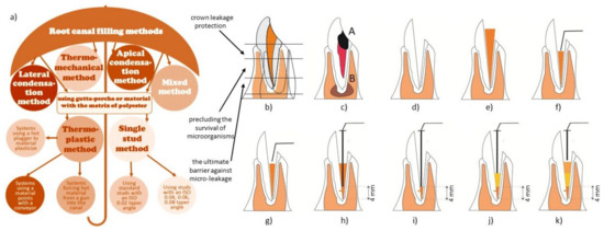 Metals | Free Full-Text | What Are the Chances of Resilon to Dominate ...