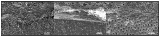 What Are the Chances of Resilon to Dominate the Market Filling ...