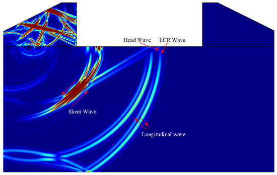 Research on an Ultrasonic Longitudinal Critically Refracted Wave ...