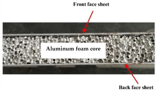 Research Progress in the Preparation of Aluminum Foam Composite Structures