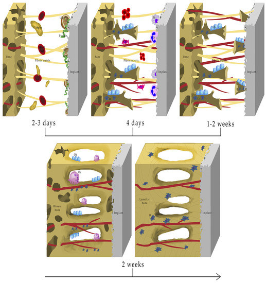 Surface Modification Techniques for Metallic Biomedical Alloys: A ...