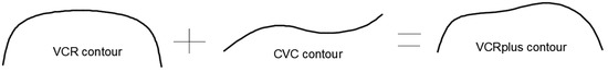 Study on the VCRplus Back-Up Roll Contour of 1500 mm CVC Mill