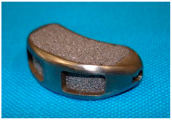 Titanium Alloy Fabricated by Additive Manufacturing for Medical ...