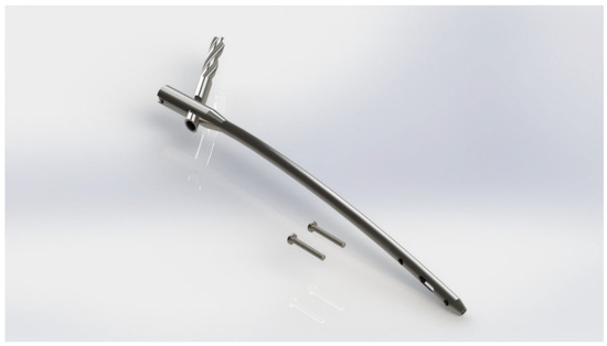 Failure Analysis of a Femoral Cephalomedullary Nail