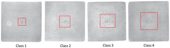 Deep Learning-Based Understanding of Defects in Continuous Casting Product