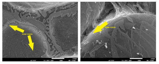 Effect of Gating System Design on the Quality of Aluminum Alloy Castings