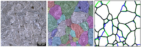 Overview Machine Learning For Segmentation And Classification Of Complex Steel Microstructures