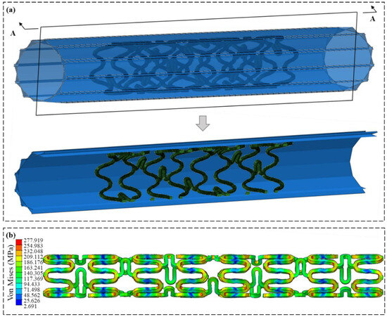 Design and Mechanical Performance Evaluation of WE43 Magnesium Alloy ...