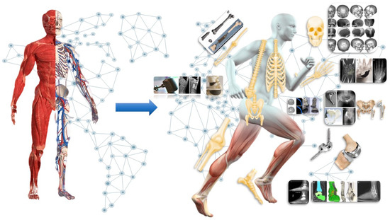Advancements in Metal Processing Additive Technologies: Selective Laser ...