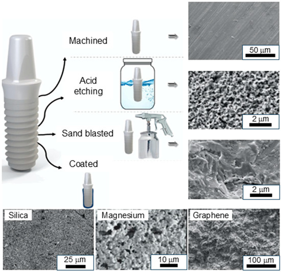 Improving the Clinical Performance of Dental Implants Through Advanced ...