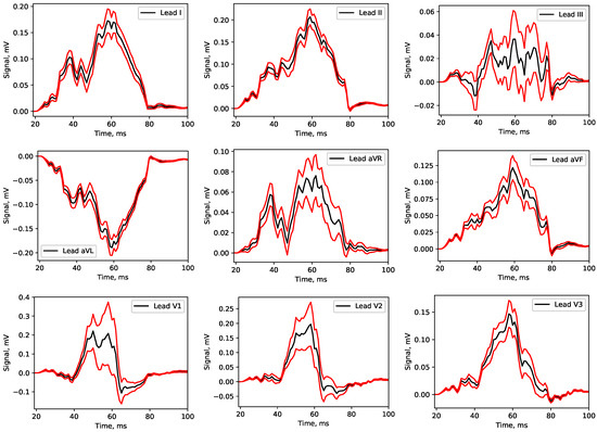 Global Sensitivity Analysis and Uncertainty Quantification for ...
