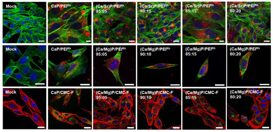 Micro | Free Full-Text | In-Vitro Cell Response to Strontium/Magnesium-Doped Calcium Phosphate ...