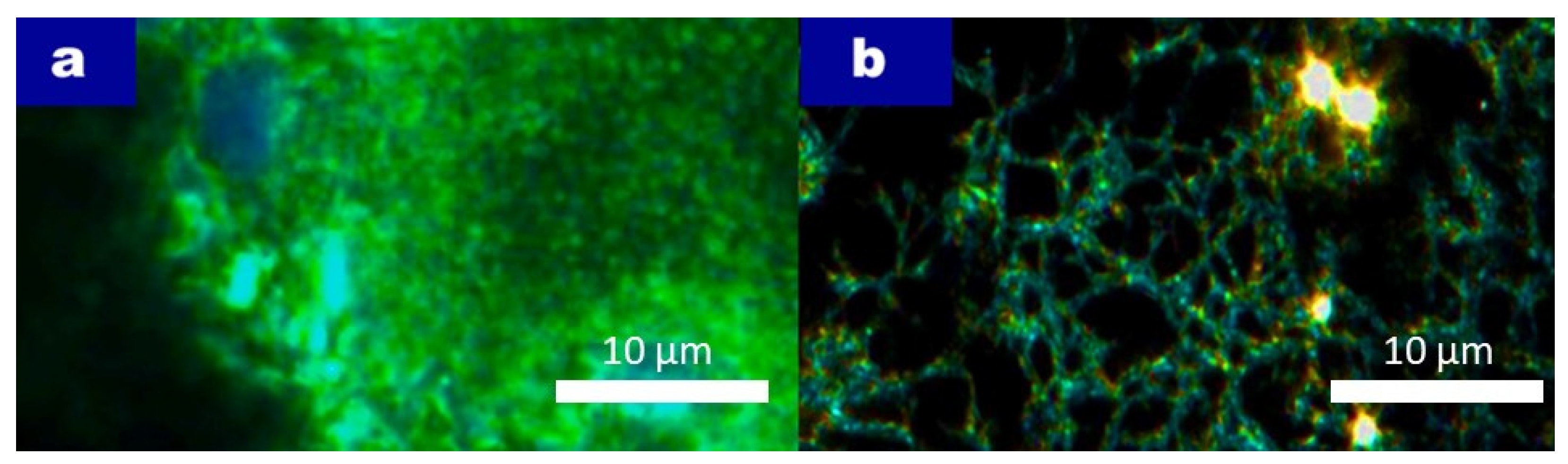 Pullulan/Collagen Scaffolds Promote Chronic Wound Healing via ...