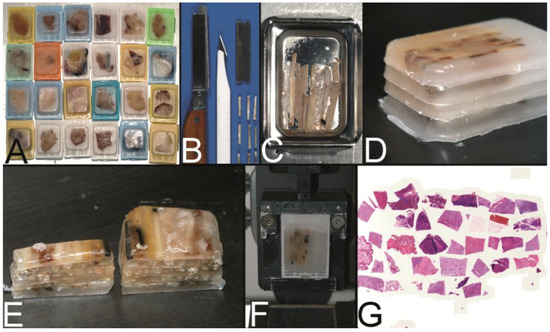Overview on Techniques to Construct Tissue Arrays with Special Emphasis ...