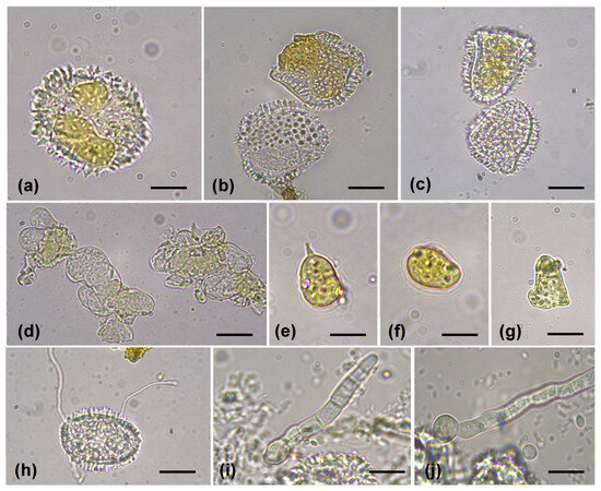 First Occurrence of Coffee Leaf Rust Caused by Hemileia vastatrix on ...