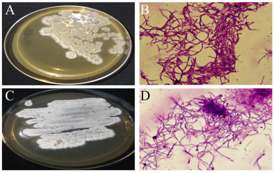 Exploring the Antimicrobial and Antioxidant Activities of Streptomyces ...