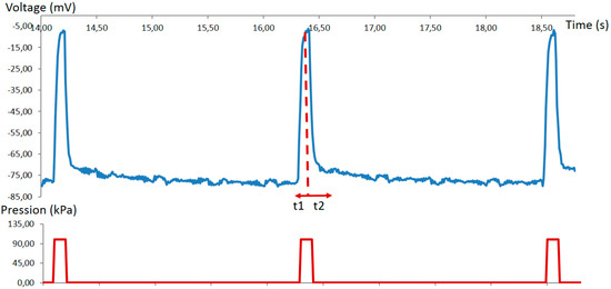 Microfluidic Neurons, a New Way in Neuromorphic Engineering?