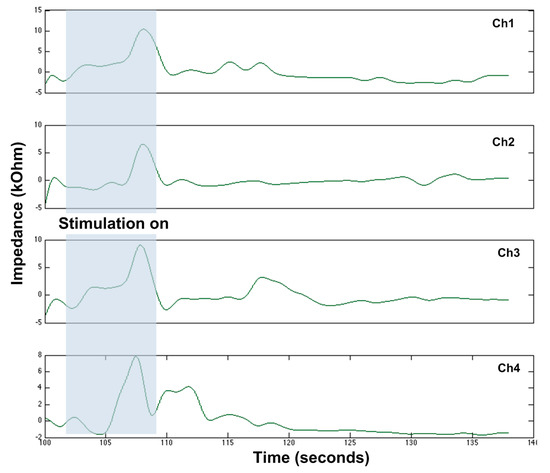 A Wireless Implant for Gastrointestinal Motility Disorders