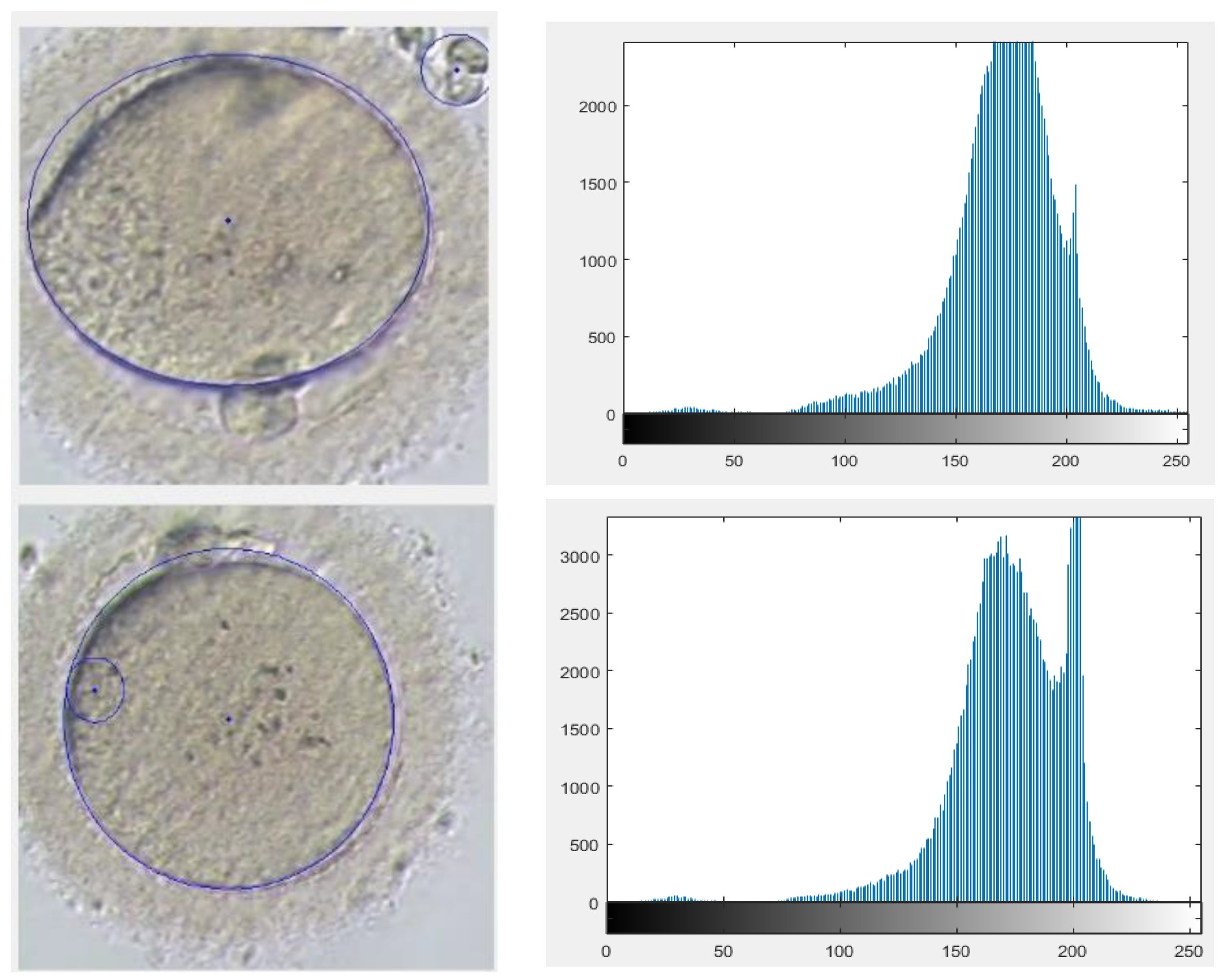 Micromachines | Free Full-Text | Oocyte Positional Recognition for Automatic Manipulation in ICSI