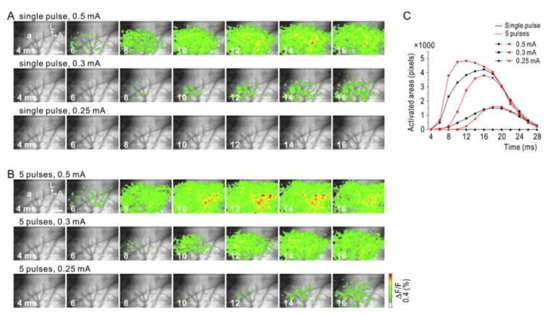 Progress in the Field of Micro-Electrocorticography