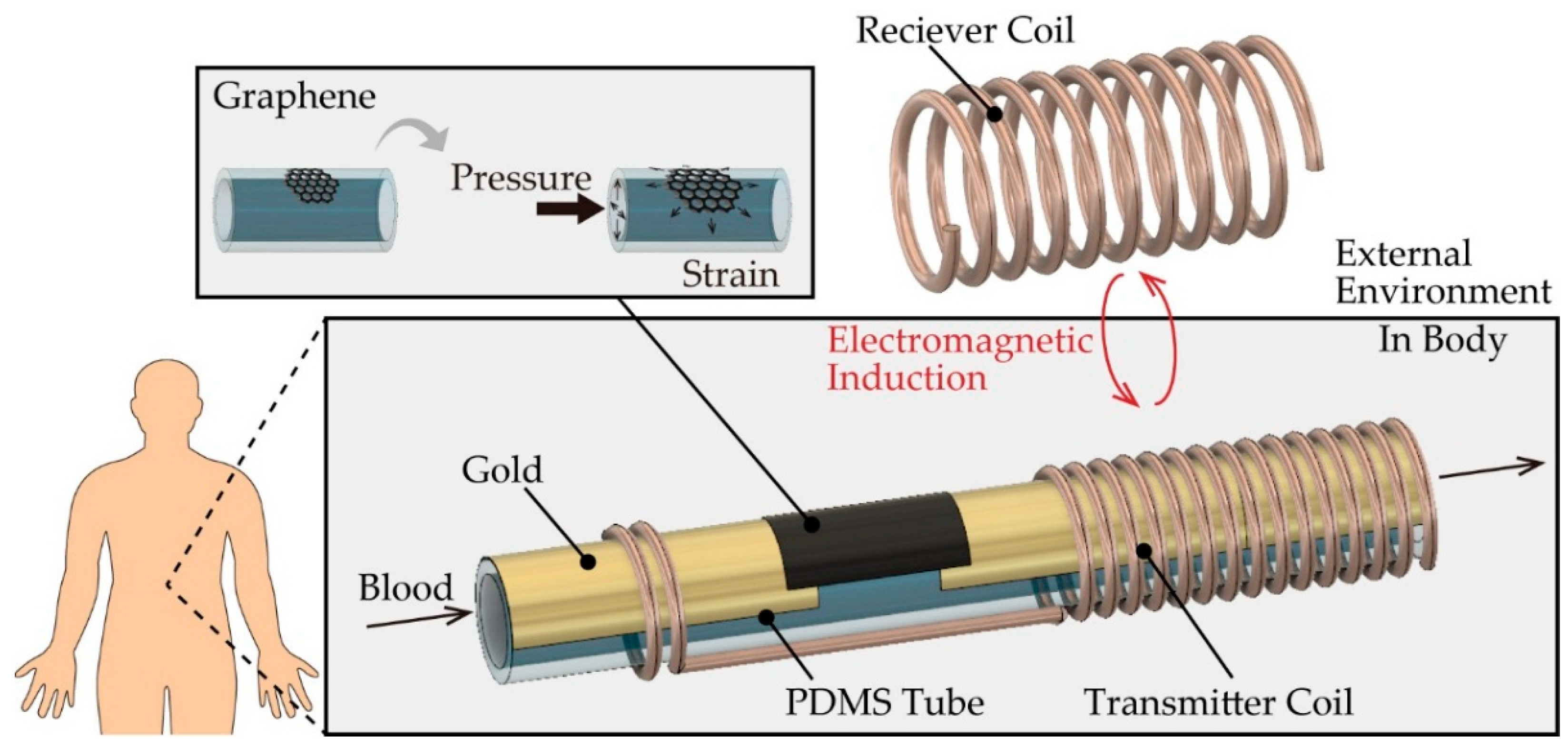 Graphene-Based Wireless Tube-Shaped Pressure Sensor for In Vivo Blood ...