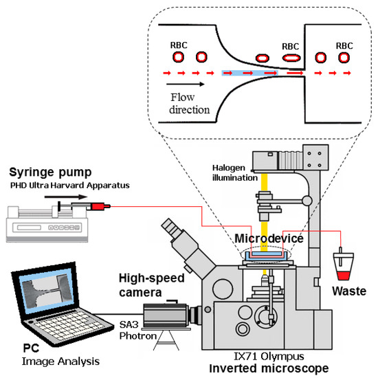 A Microfluidic Deformability Assessment of Pathological Red Blood Cells ...
