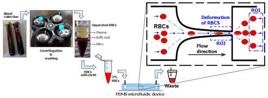 A Microfluidic Deformability Assessment of Pathological Red Blood Cells ...