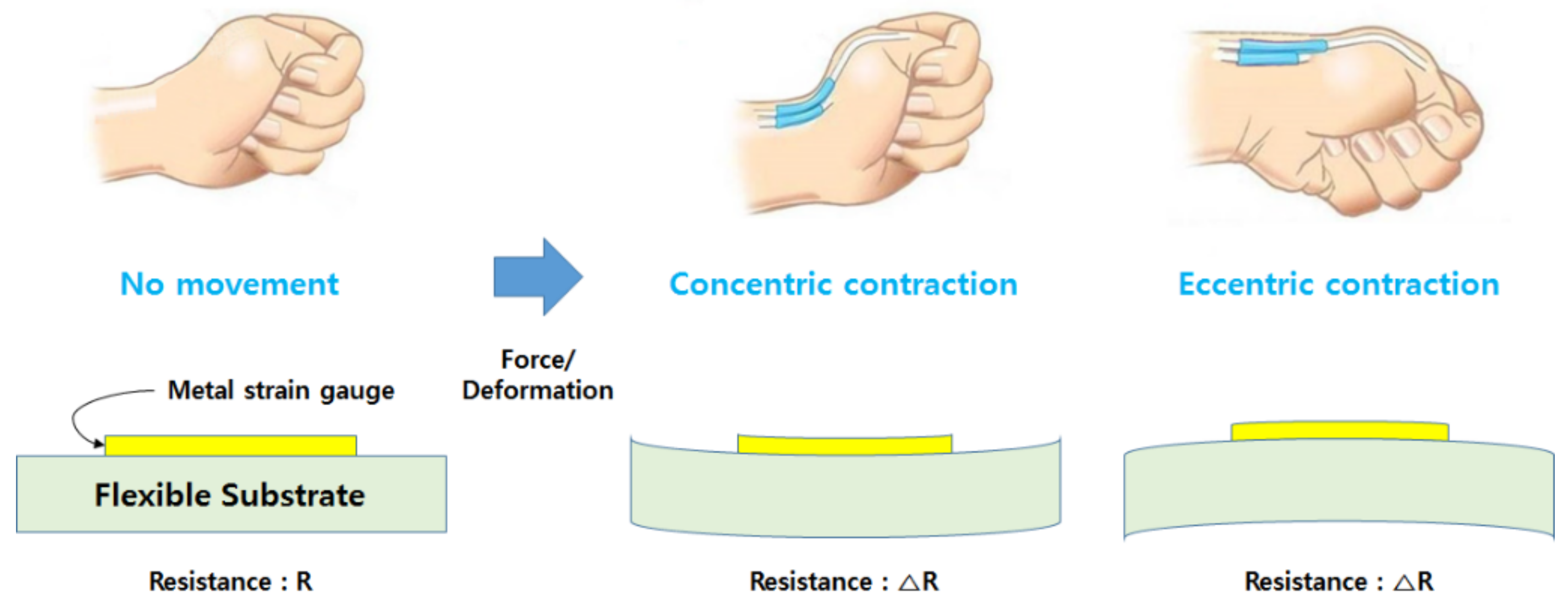 Implementation of Hand Gesture Recognition Device Applicable to Smart ...
