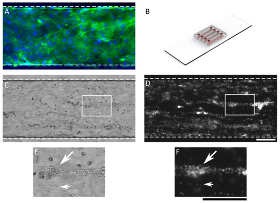 Automated Analysis of Platelet Aggregation on Cultured Endothelium in a ...