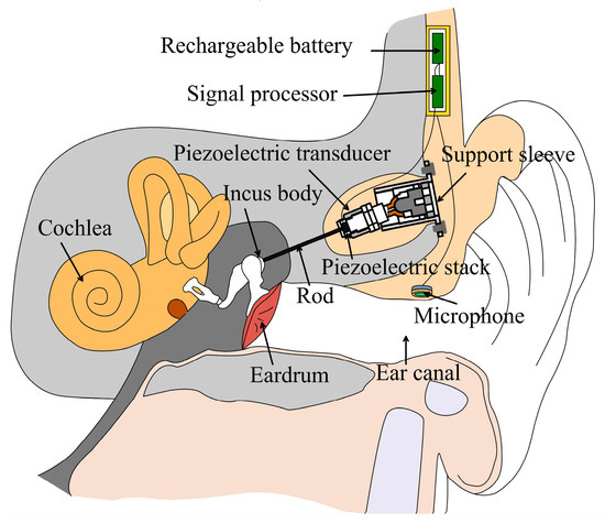 The Influence of Piezoelectric Transducer Stimulating Sites on the ...