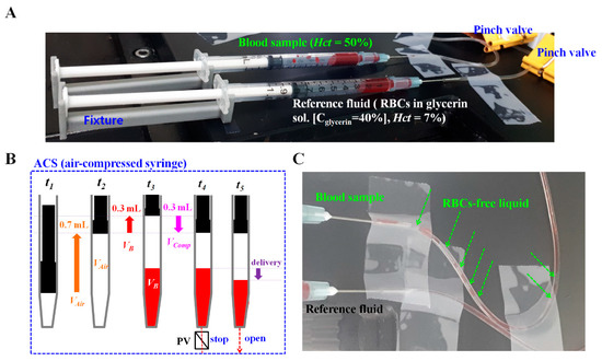 Microfluidic-Based Biosensor for Blood Viscosity and Erythrocyte ...