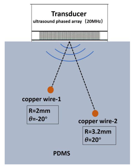 PIN-PMN-PT Single Crystal 1-3 Composite-based 20 MHz Ultrasound Phased ...