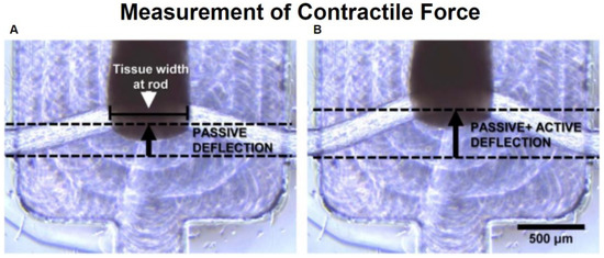 Lab-on-a-Chip for Cardiovascular Physiology and Pathology