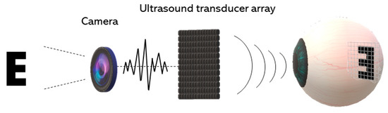 Ultrasonic Retinal Neuromodulation and Acoustic Retinal Prosthesis