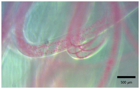Acoustic Cell Patterning in Hydrogel for Three-Dimensional Cell Network ...