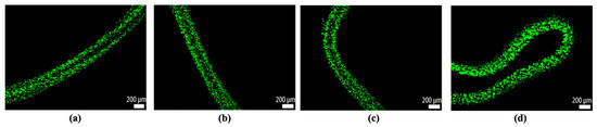 Acoustic Cell Patterning in Hydrogel for Three-Dimensional Cell Network ...