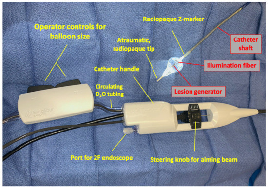 Clinical Applications of Laser Technology: Laser Balloon Ablation in ...