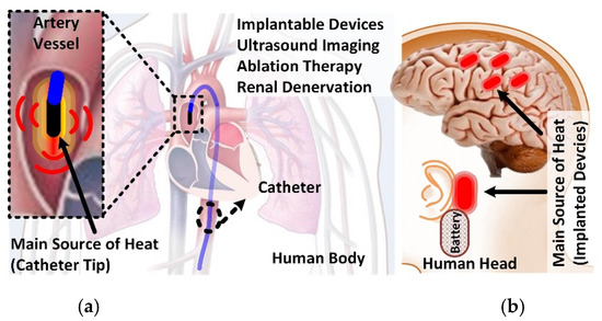 Thermal Analysis of Heat Transfer from Catheters and Implantable ...