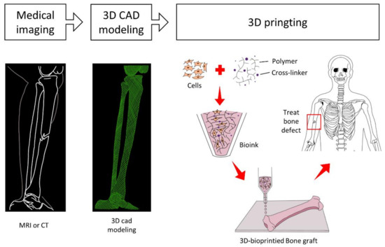3D-Bioprinting Strategies Based on In Situ Bone-Healing Mechanism for Vascularized Bone Tissue ...