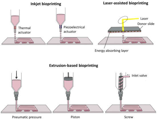 3D-Bioprinting Strategies Based on In Situ Bone-Healing Mechanism for ...