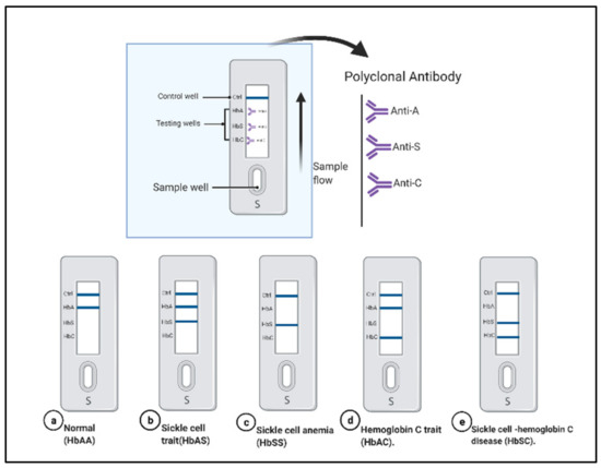 Techniques for the Detection of Sickle Cell Disease: A Review