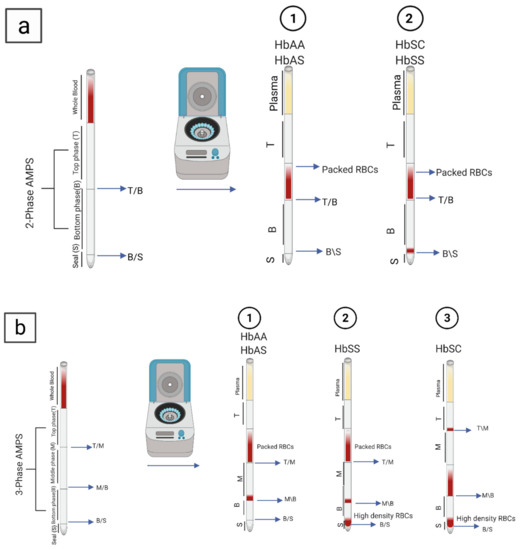 Techniques for the Detection of Sickle Cell Disease: A Review