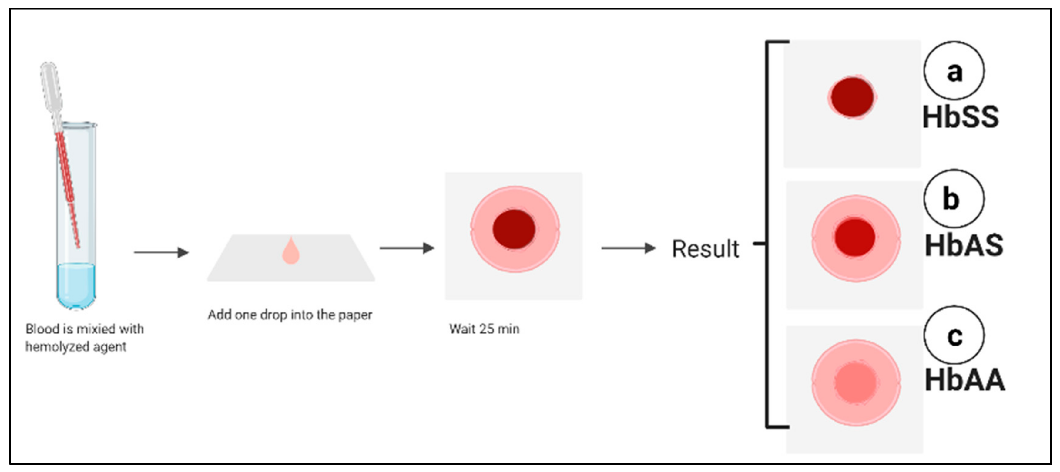 Micromachines | Free Full-Text | Techniques for the Detection of Sickle ... Micromachines | Free Full-Text | Techniques for the Detection of Sickle ...